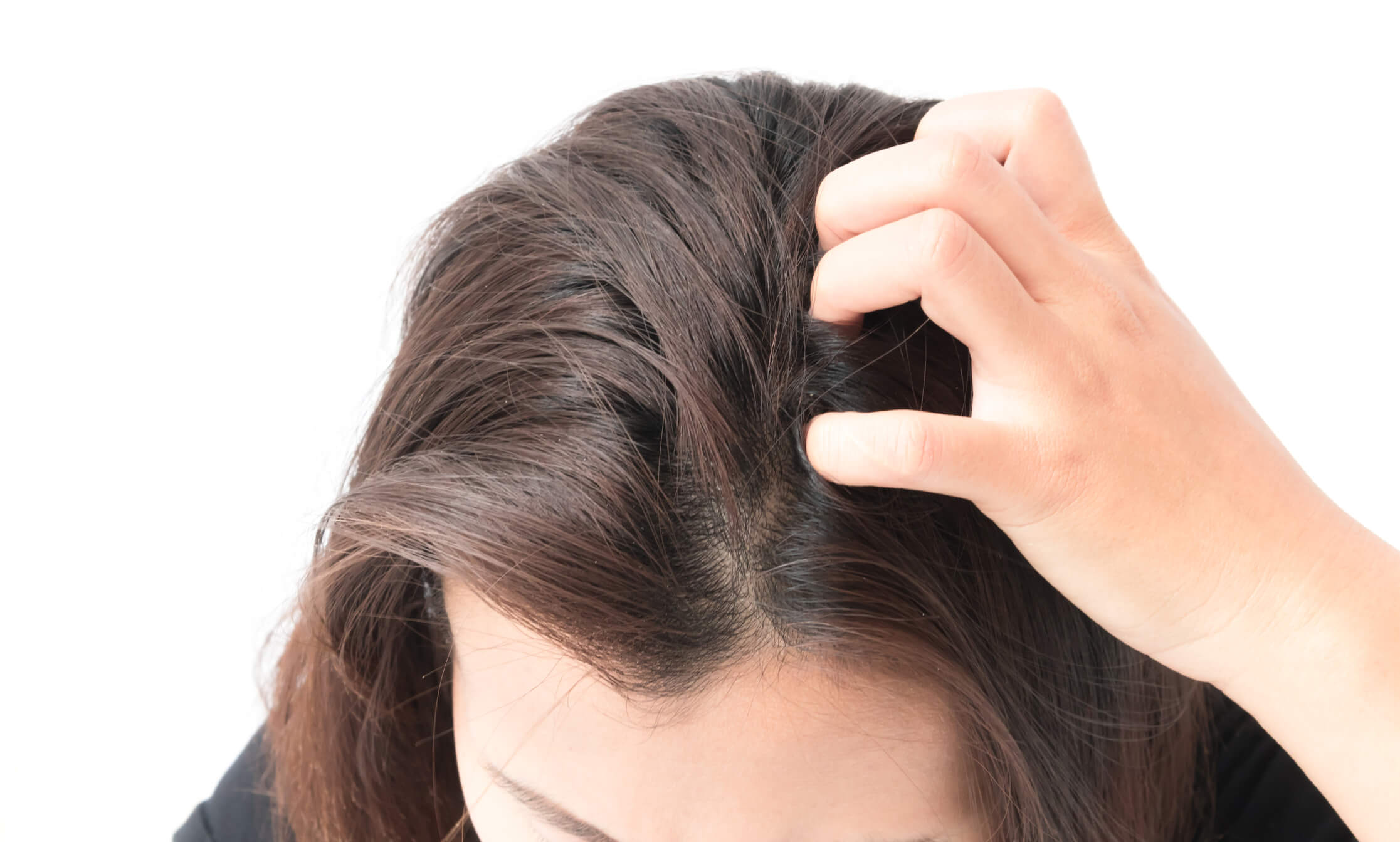 Does Picking at Your Scalp Cause Hair Loss?